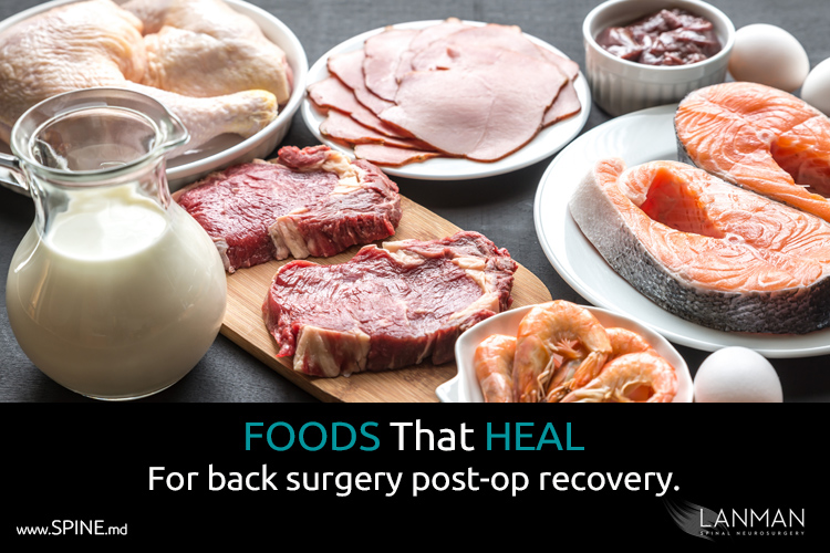 Diets that Help with Post-Operative Healing | Spine.MD