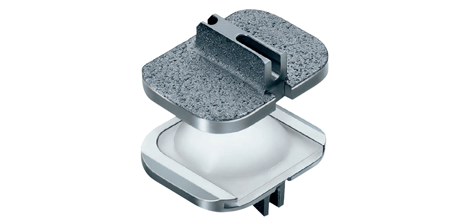 Types of Artificial Disc Replacement | Spine.MD