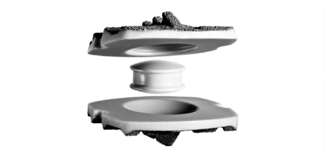 Types of Artificial Disc Replacement | Spine.MD